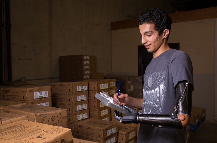 Amputation Levels | Arm Dynamics